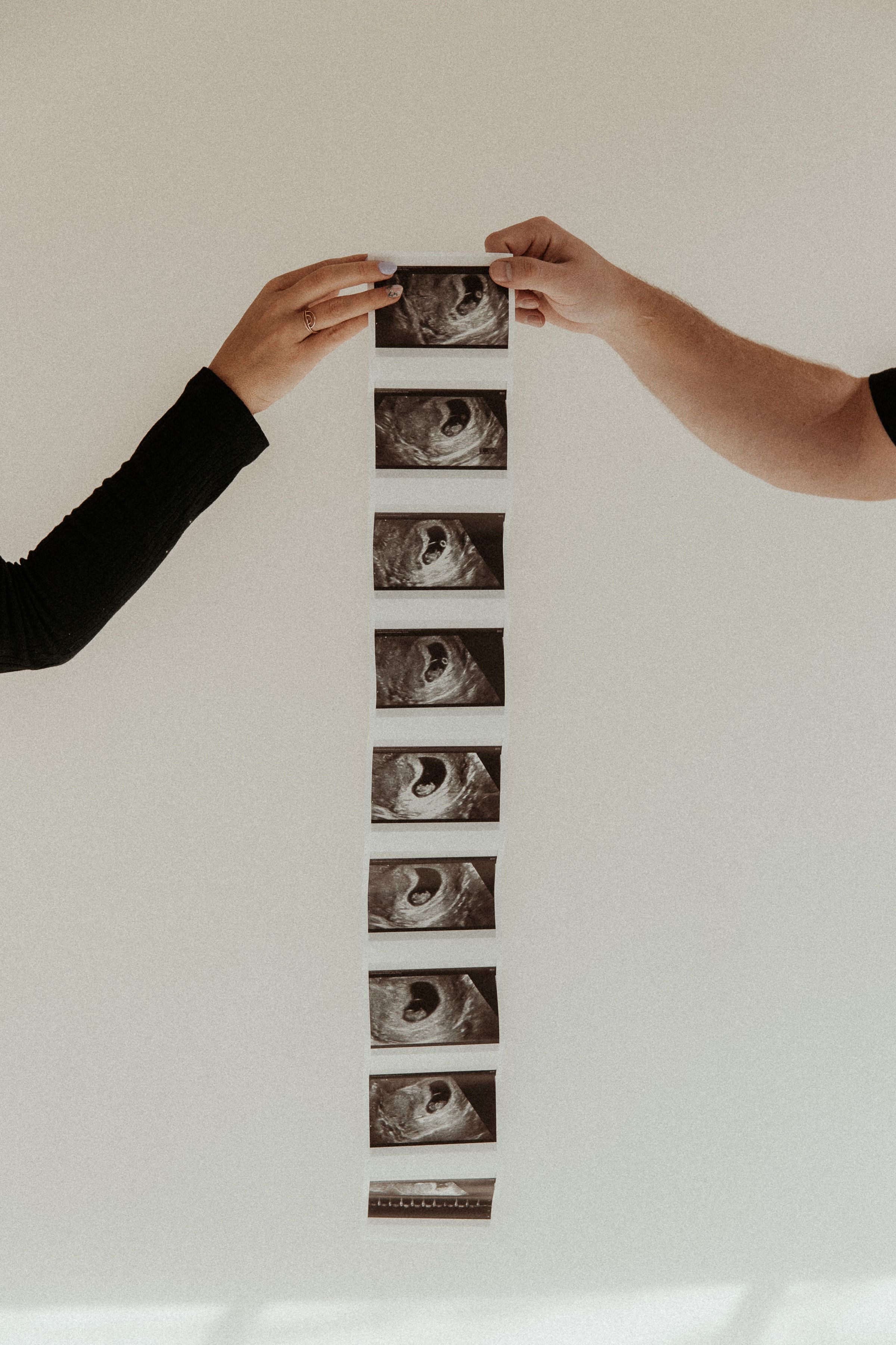 The Ultimate Maternity Photoshoot Guide: Tips for Expecting Mothers ...