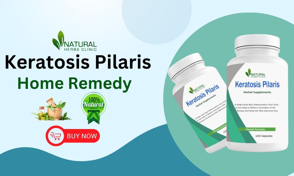 6 Home Remedies For Keratosis Pilaris - Natural Treatment (That Work ...
