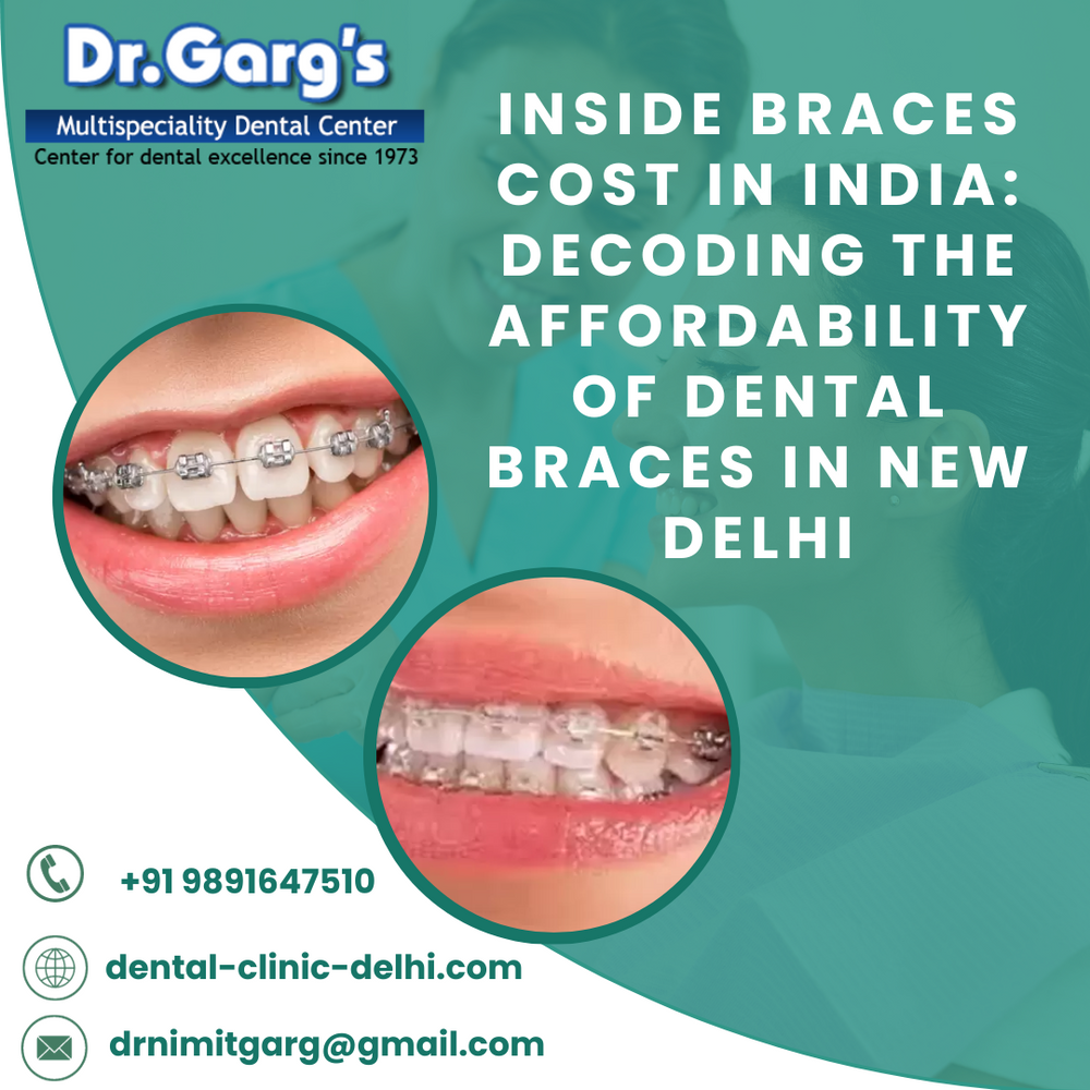 Inside Braces Cost in India: Decoding the Affordability of Dental ...