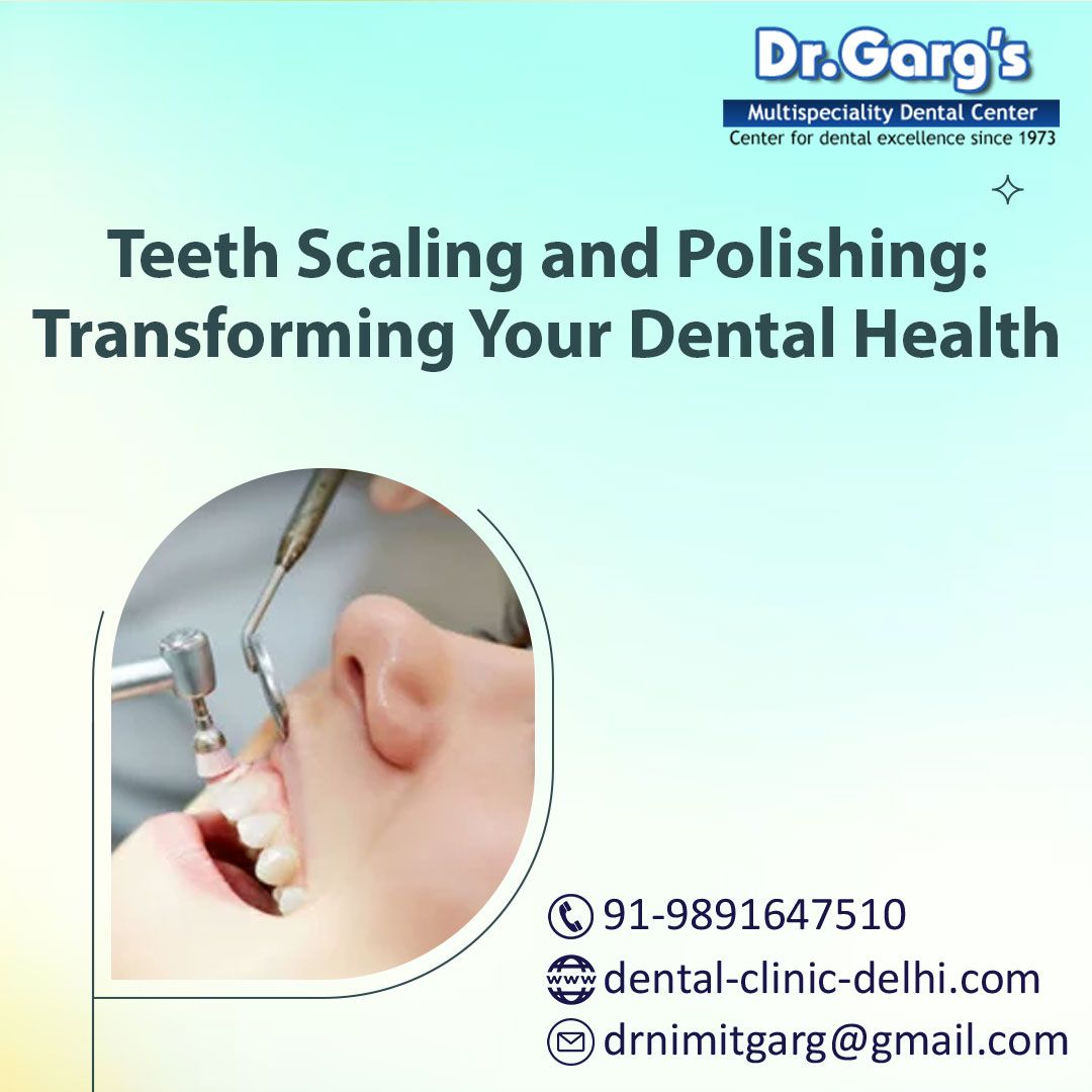 Teeth Scaling and Polishing: Transforming Your Dental Health ...