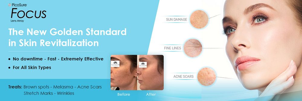 The Ultimate Guide to Microblading Removal in New York, NY - Laser ...