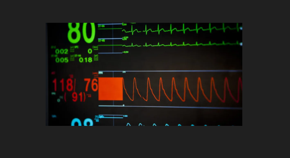 Why “Normal Vitals” Don’t Always Mean a Stable Patient - Smith Legal ...